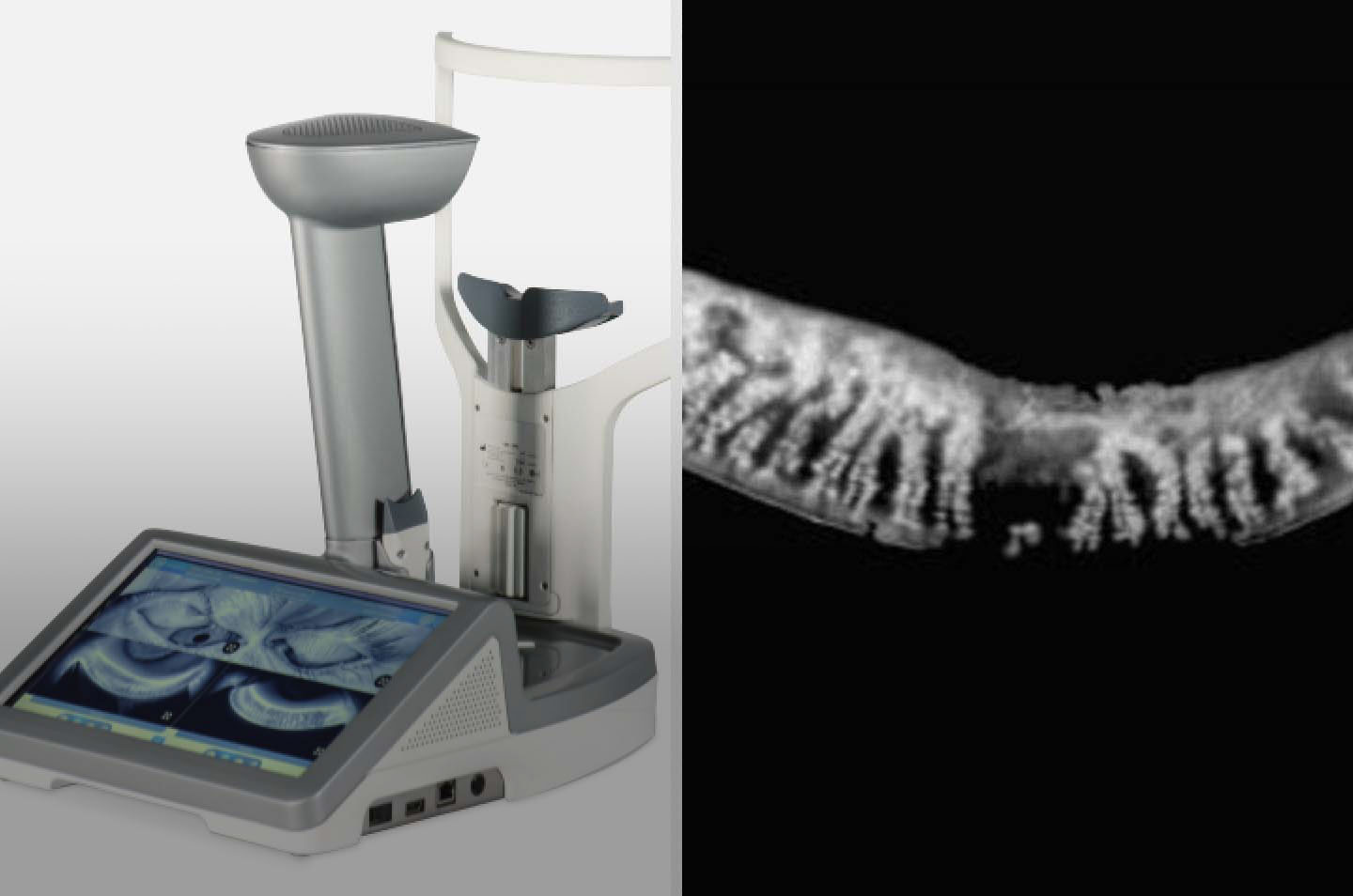 Medical Device Design Company | Blur Product Development